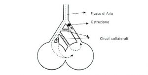La Pep mask, l’alleata dei fisioterapisti – Vite Salate